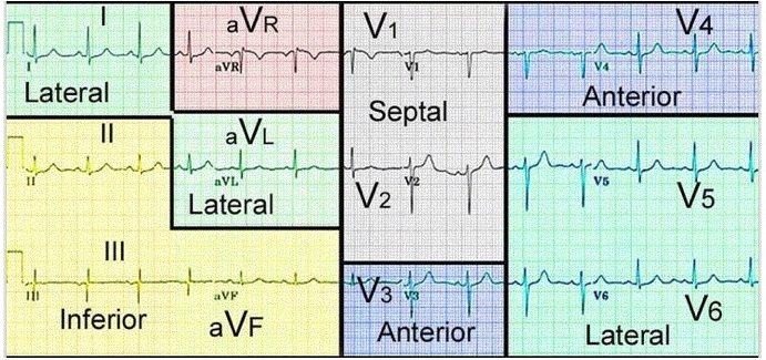 09-Main ECG Slide - ED Quality Solutions, LLC