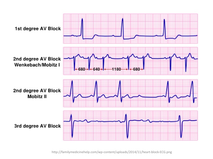28-Blocks - ED Quality Solutions, LLC